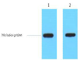 His-Tag Rabbit Polyclonal Antibody