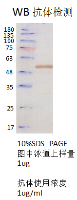 HPV 39-L1兔多克隆抗体-HRP