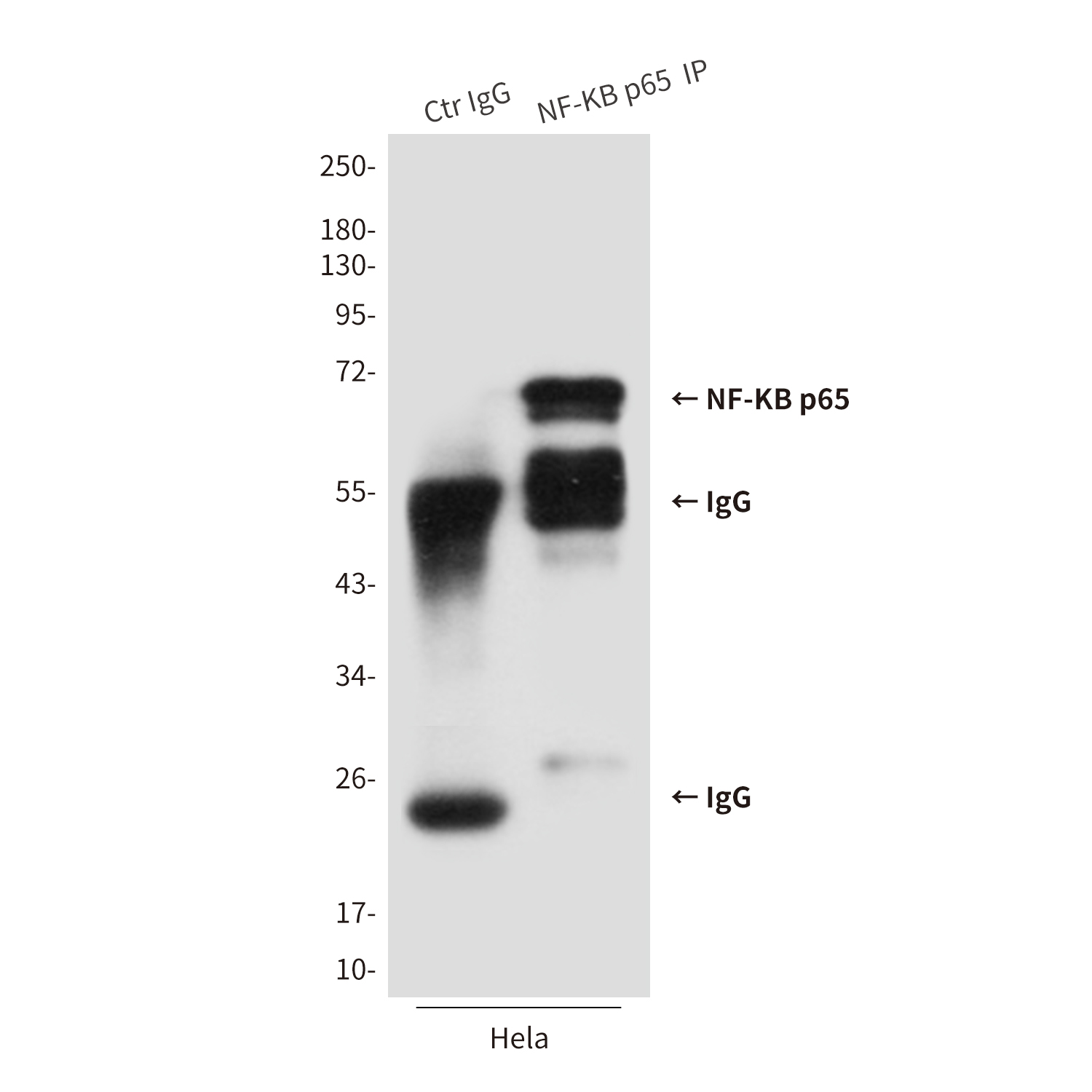 NF-KB p65 (15B2) Mouse Monoclonal Antibody