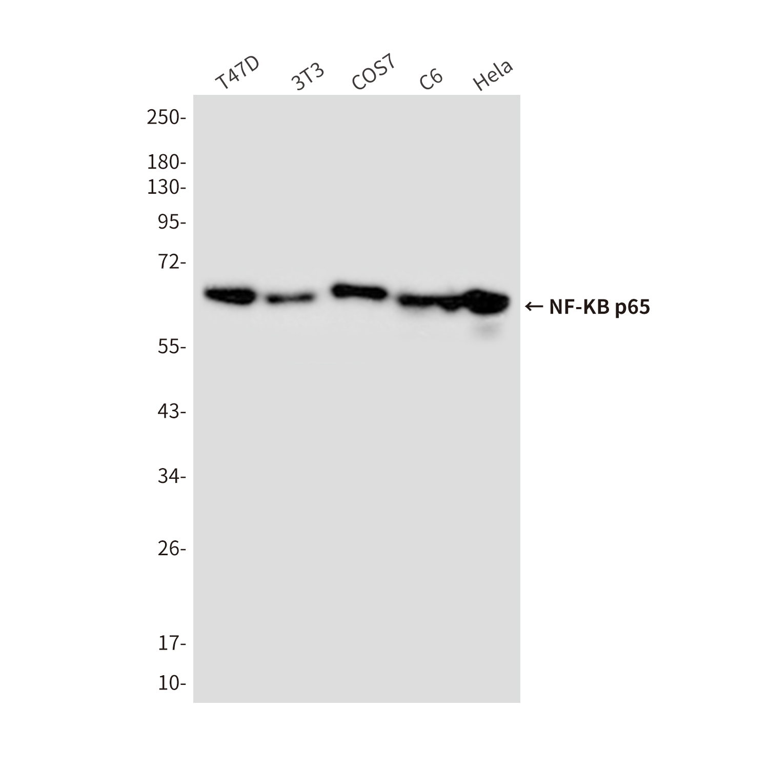 NF-KB p65 (15B2) Mouse Monoclonal Antibody