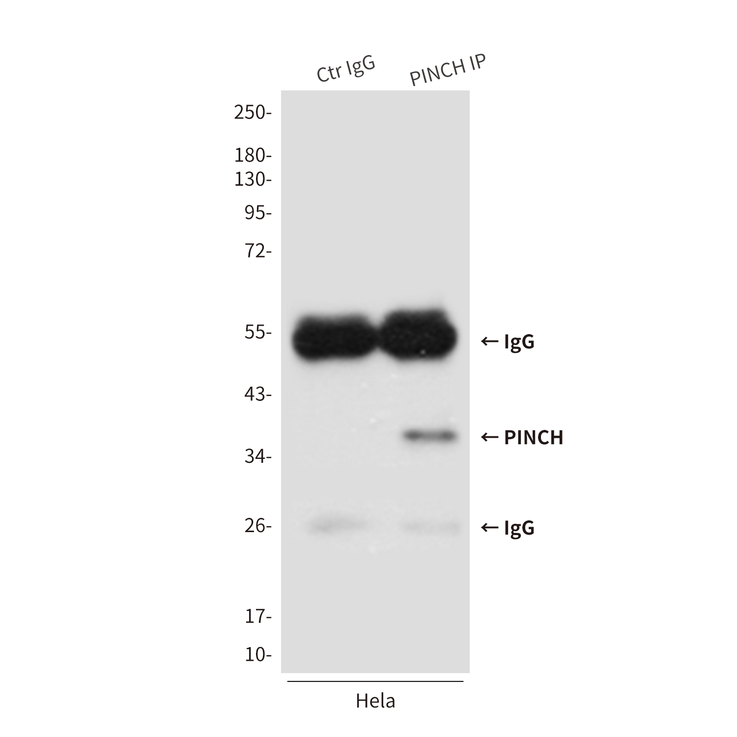 PINCH (2J3) Mouse Monoclonal Antibody