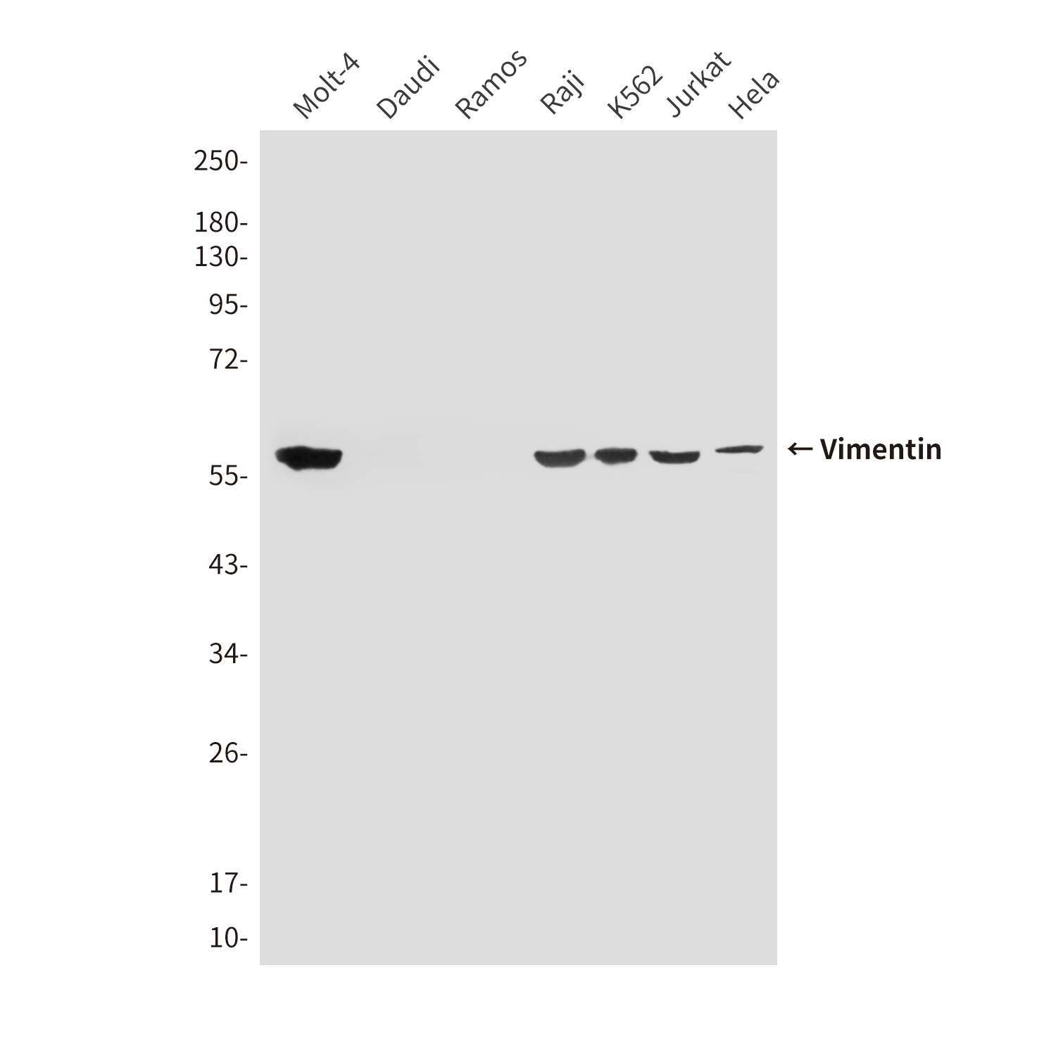 Vimentin (19R15) Mouse Monoclonal Antibody