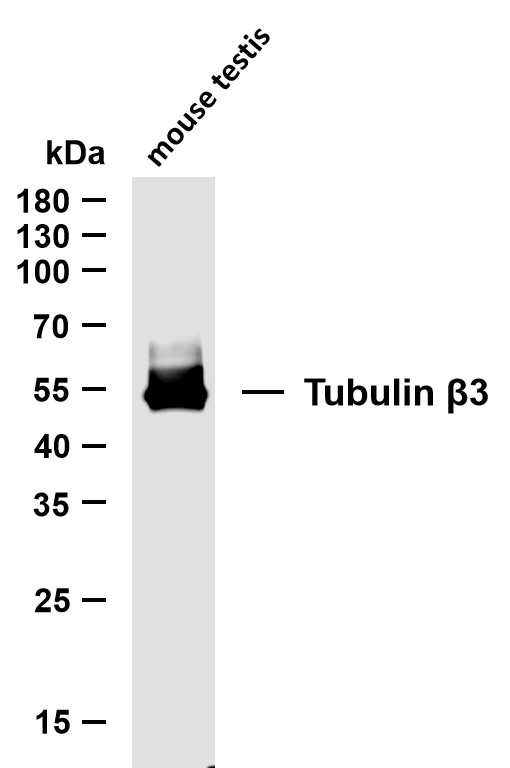 Tubulin beta-3 (9I17) Mouse Monoclonal Antibody