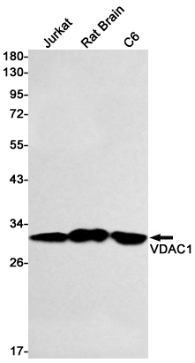 VDAC1 (12N10) Rabbit Monoclonal Antibody
