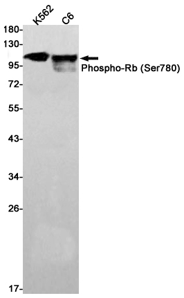Retinoblastoma (Phospho S780) (9H2) Rabbit Monoclonal Antibody