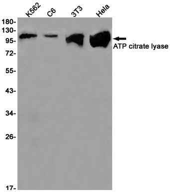 ATP citrate lyase (8L17) Rabbit Monoclonal Antibody