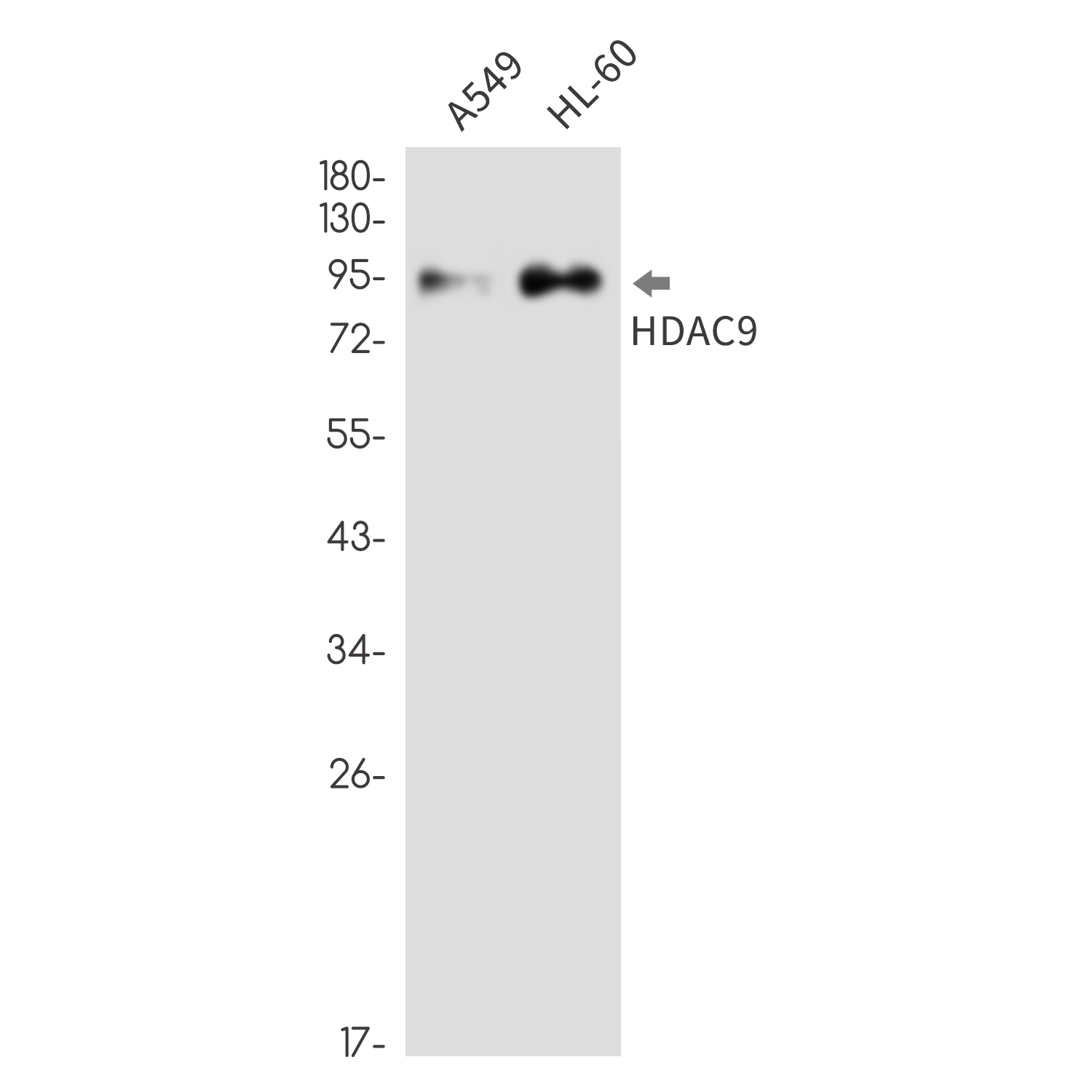 HDAC9 (10I3) Rabbit Monoclonal Antibody