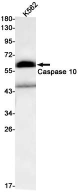 Caspase-10 (1R16) Rabbit Monoclonal Antibody
