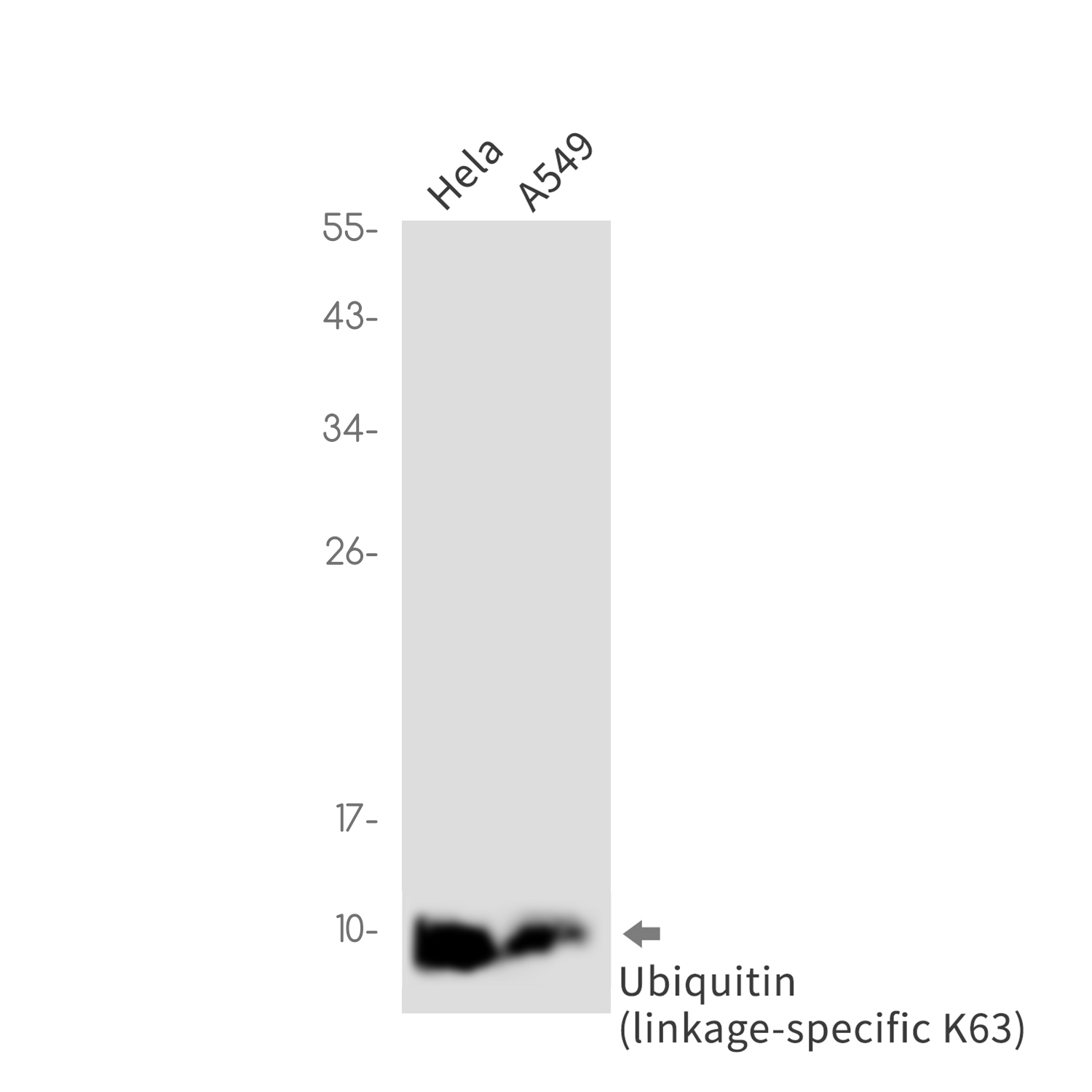 Ubiquitin K63 (4W15) Rabbit Monoclonal Antibody