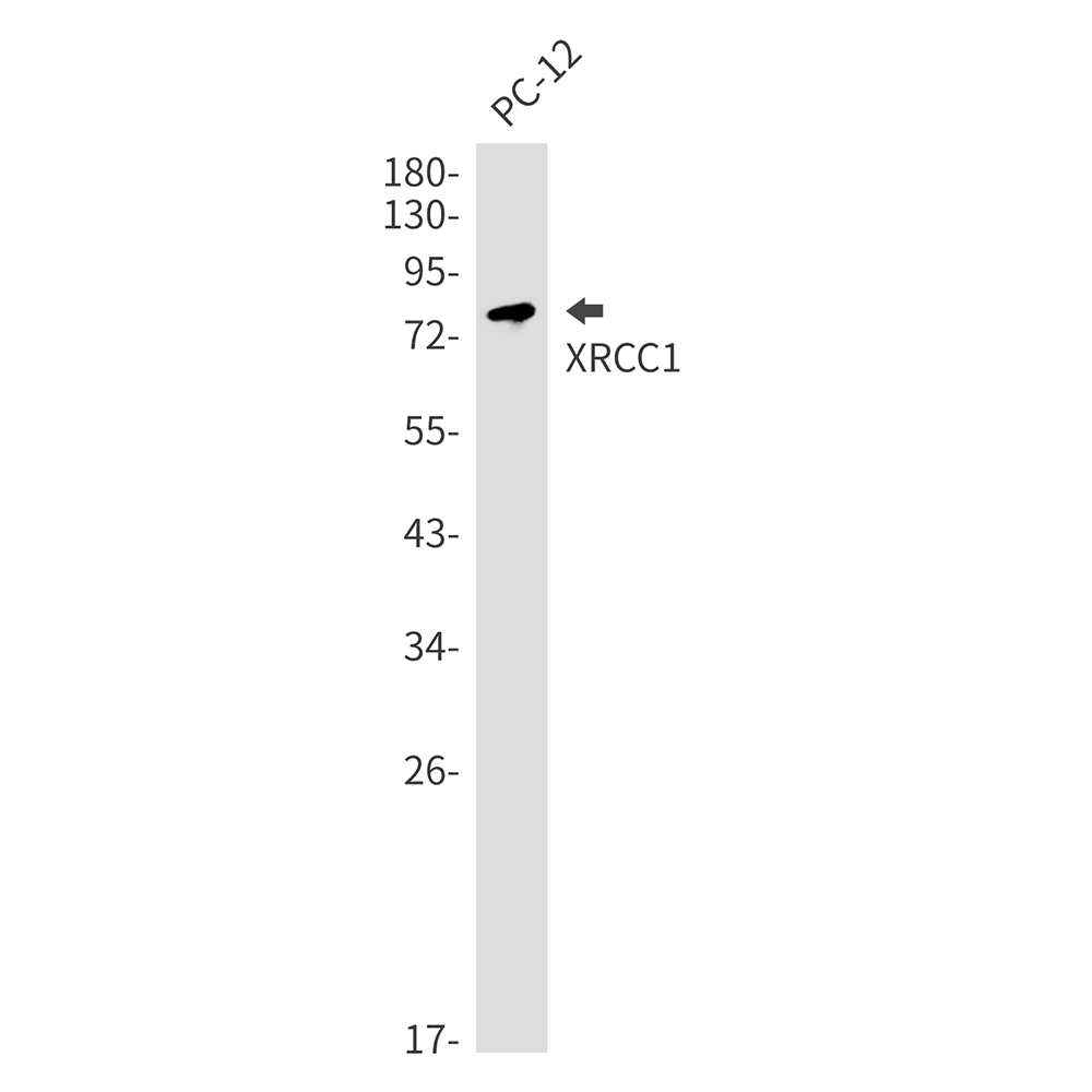 XRCC1 (19W2) Rabbit Monoclonal Antibody