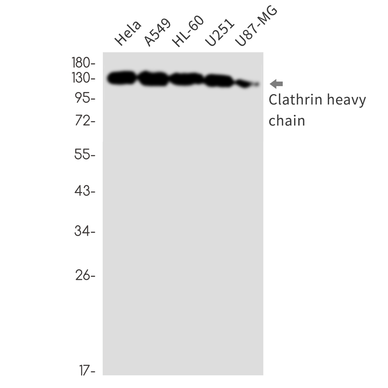 Clathrin heavy chain (18K9) Rabbit Monoclonal Antibody