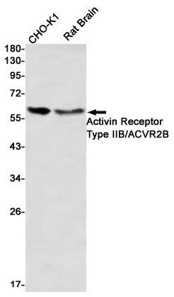 Activin Receptor Type IIB/ACVR2B (2S5) Rabbit Monoclonal Antibody