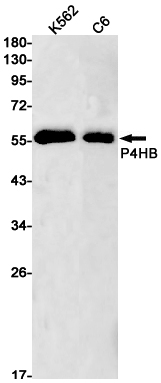 P4HB (13T8) Rabbit Monoclonal Antibody