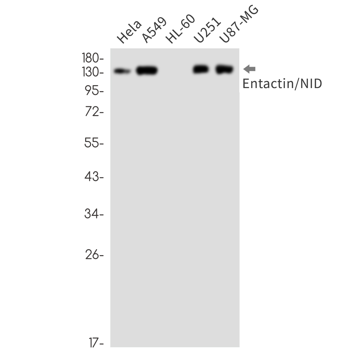 Entactin (18K6) Rabbit Monoclonal Antibody
