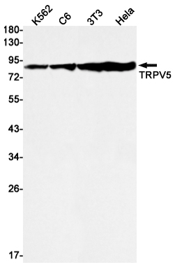 TRPV5 (9W9) Rabbit Monoclonal Antibody