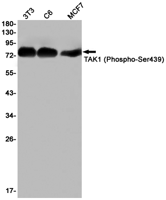 TAK1 (Phospho S439) (1B14) Rabbit Monoclonal Antibody