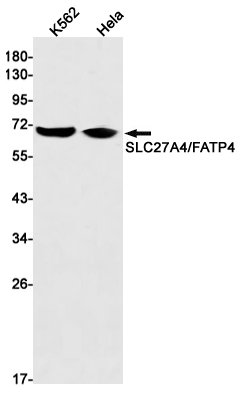 SLC27A4 (1C18) Rabbit Monoclonal Antibody