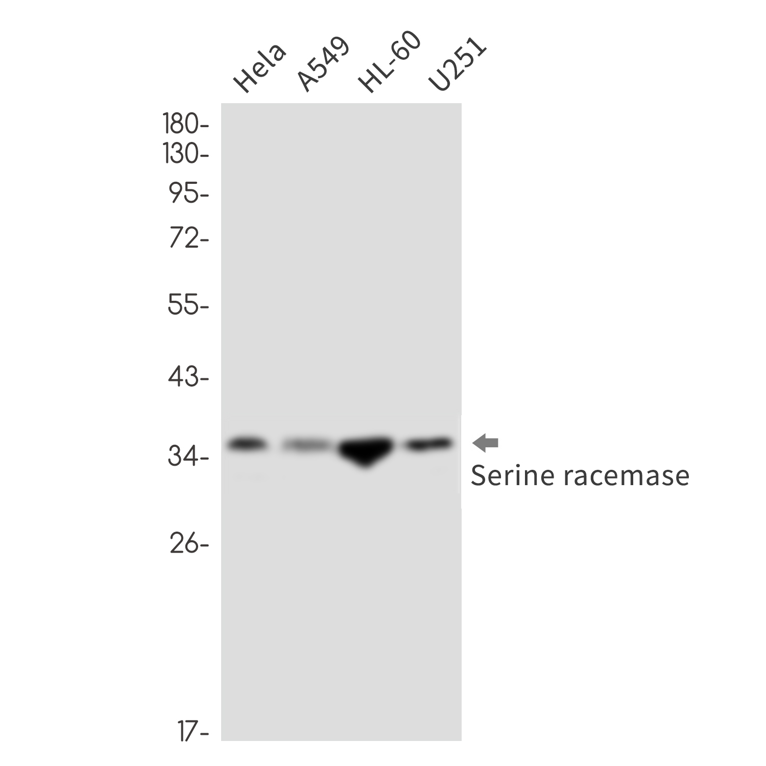 Serine racemase (5F16) Rabbit Monoclonal Antibody