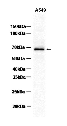 NF-κB p65 (5I3) Rabbit Monoclonal Antibody