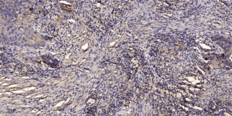 CK19(11F5)Mouse Monoclonal Antibody