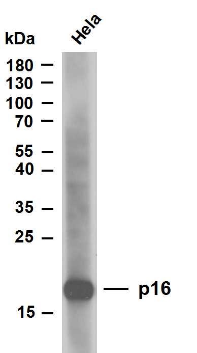 p16 INK(PTR2301)Mouse Monoclonal Antibody