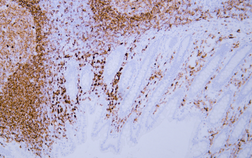CD79a (3A2) Mouse Monoclonal Antibody