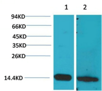 S100 β Rabbit Polyclonal Antibody