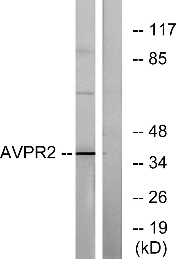 AVP Receptor V2 Rabbit Polyclonal Antibody