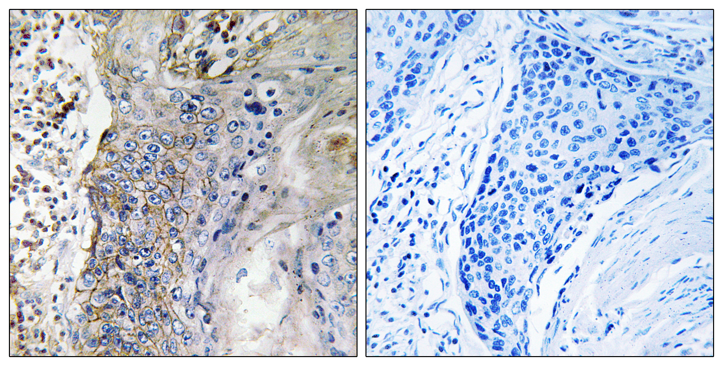 CNT2 Rabbit Polyclonal Antibody
