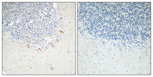 GABAA Rβ2 Rabbit Polyclonal Antibody