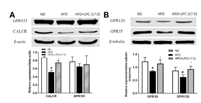 GPR35 Rabbit Polyclonal Antibody