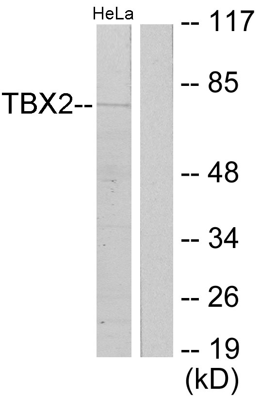 TBX2 Rabbit Polyclonal Antibody