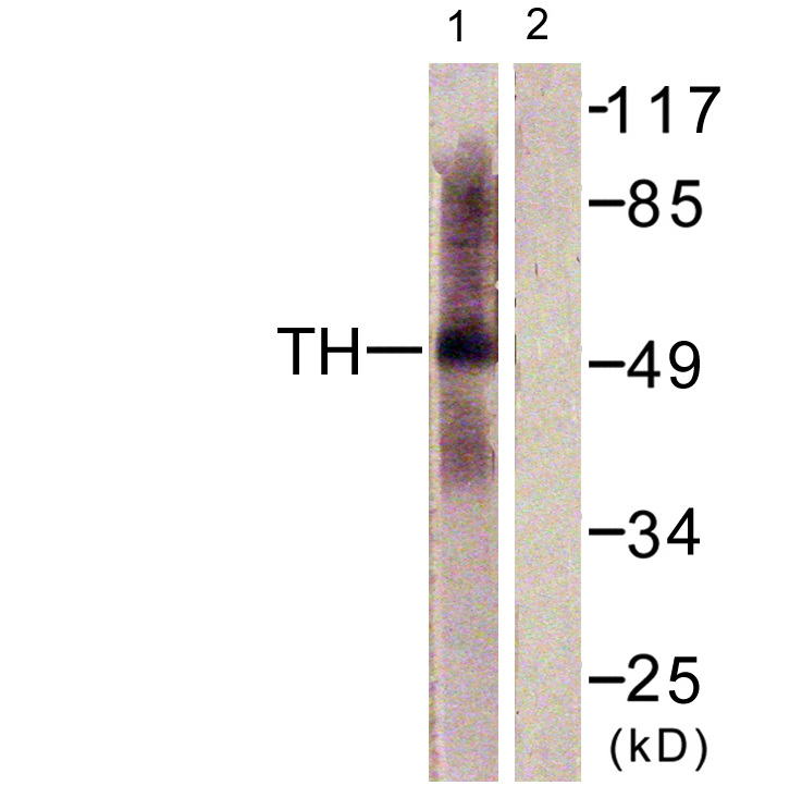 TPH1 Rabbit Polyclonal Antibody