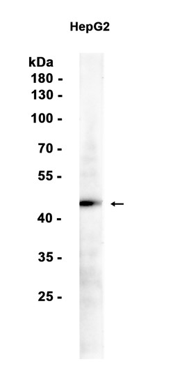 ATTY (4V3) Rabbit Monoclonal Antibody
