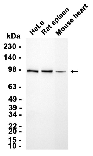EEF2 (11G9) Rabbit Monoclonal Antibody
