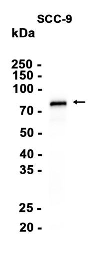TAK1 (Phospho S439) (1B14) Rabbit Monoclonal Antibody