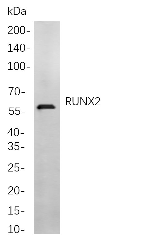 RUNX2 (15V17) Rabbit Monoclonal Antibody
