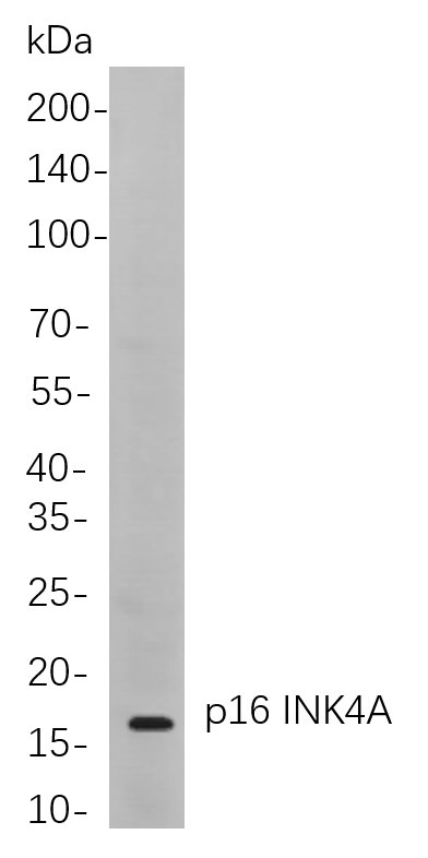 p16 INK4A (15I2) Rabbit Monoclonal Antibody