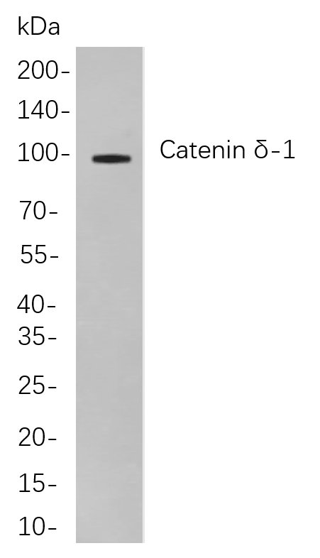 Catenin δ-1 (13I3) Rabbit Monoclonal Antibody