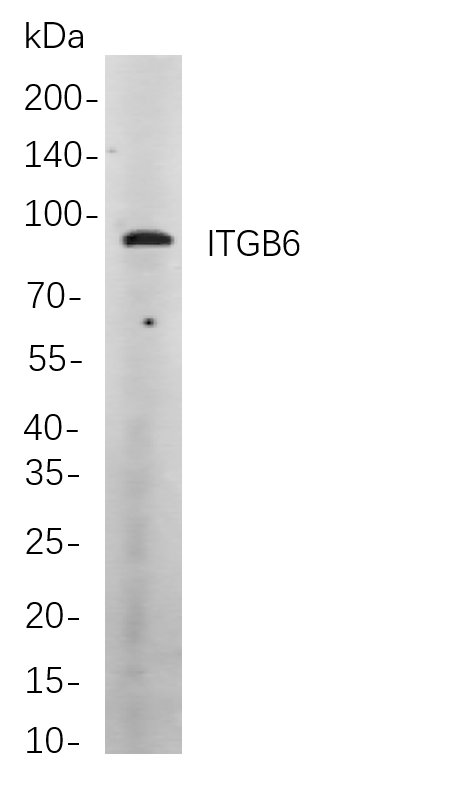 ITGB6 (12X16) Rabbit Monoclonal Antibody