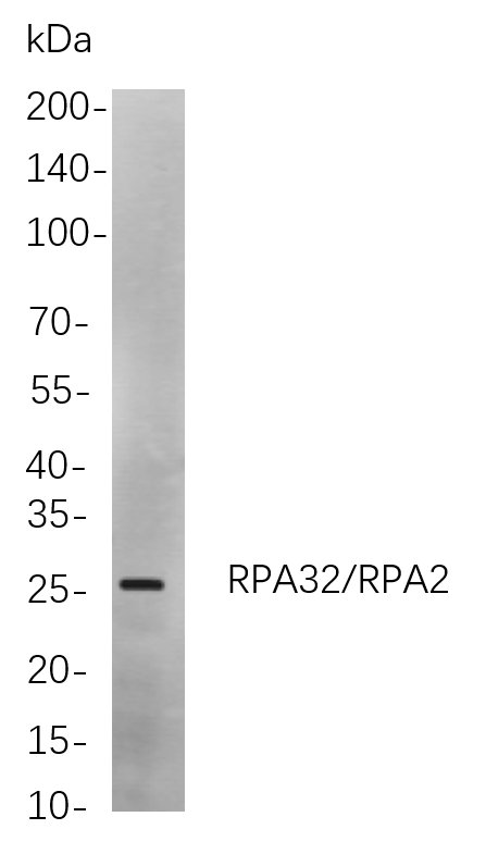RPA32/RPA2 (5C3) Rabbit Monoclonal Antibody