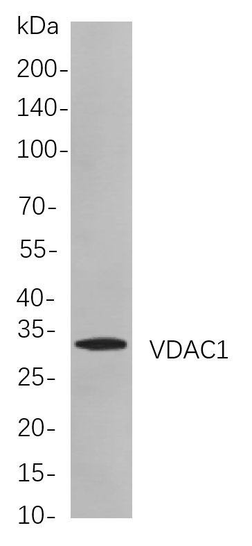 VDAC1 (11M7) Rabbit Monoclonal Antibody