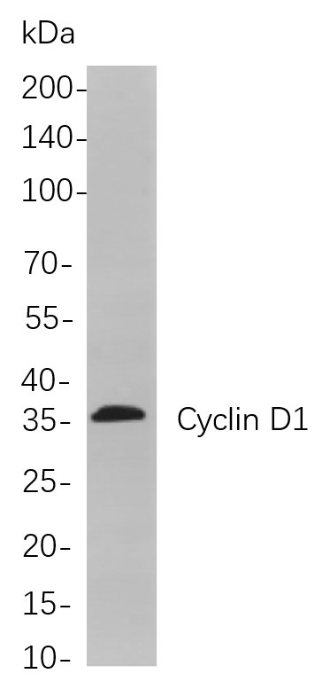 Cyclin D1 (19U18) Rabbit Monoclonal Antibody