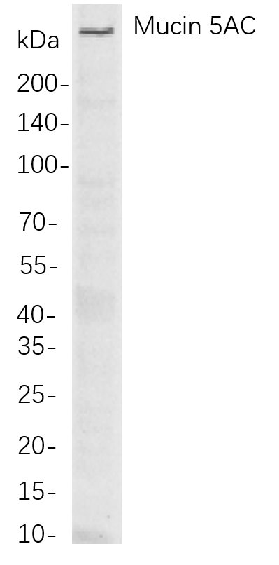 Mucin 5AC (16W2) Rabbit Monoclonal Antibody