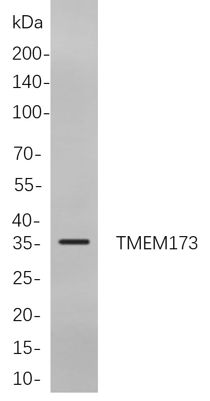 TMEM173 (16P18) Rabbit Monoclonal Antibody