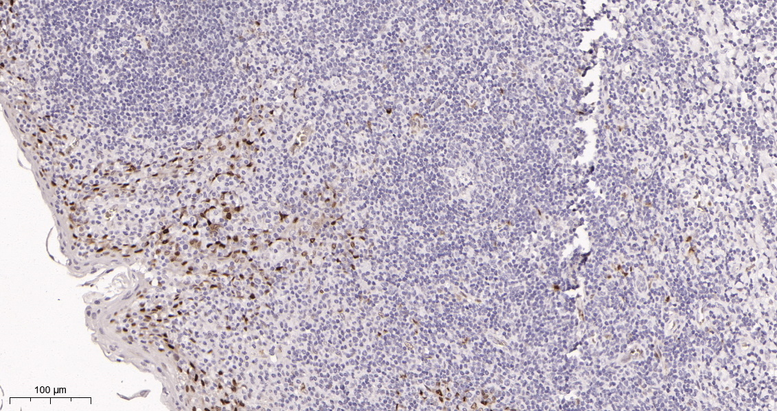 Cyclin D1 (19U18) Rabbit Monoclonal Antibody