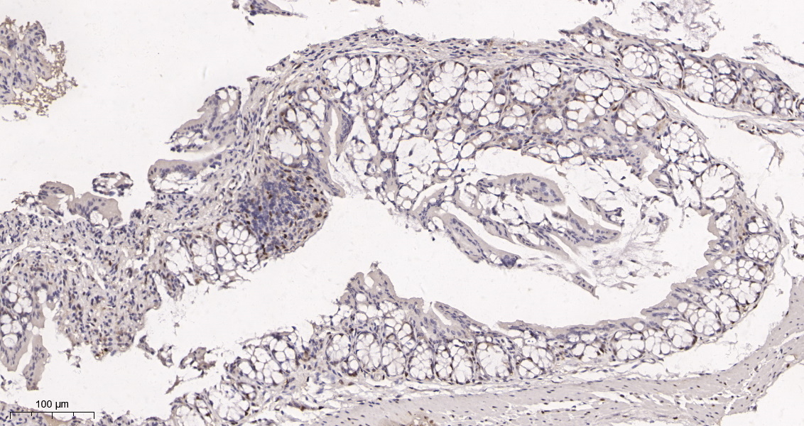 Cyclin D1 (19U18) Rabbit Monoclonal Antibody