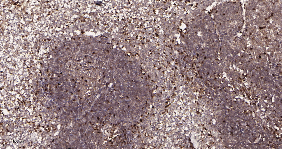 Cyclin D1 (19U18) Rabbit Monoclonal Antibody