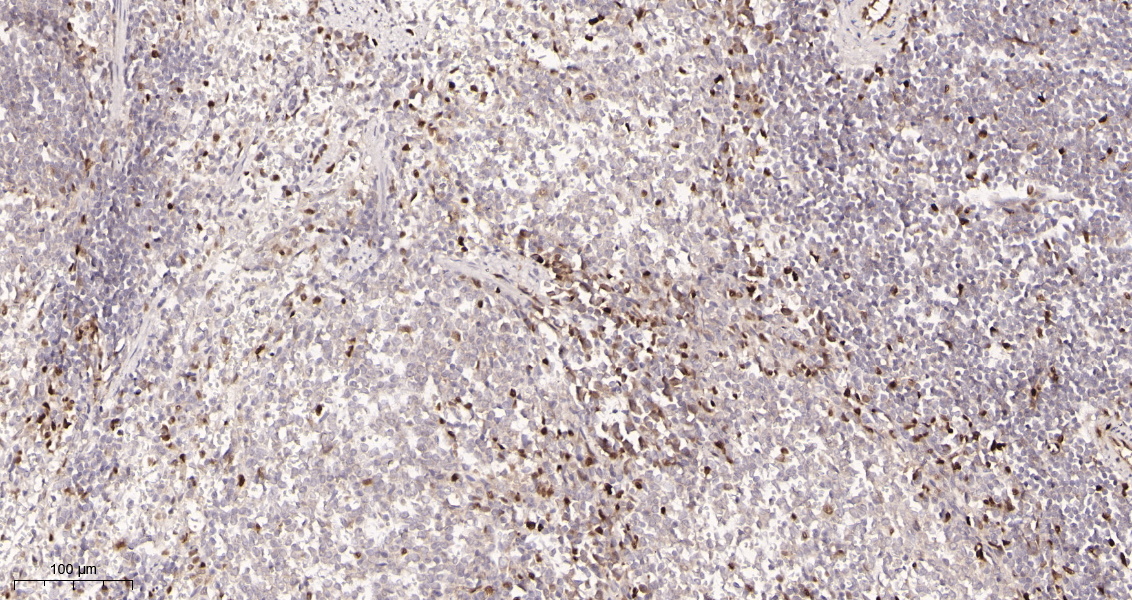 Cyclin D1 (19U18) Rabbit Monoclonal Antibody