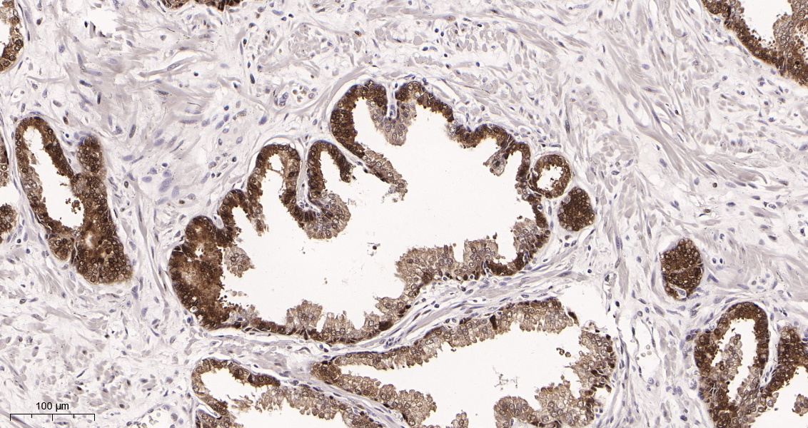Hsp70 (4D5) Rabbit Monoclonal Antibody